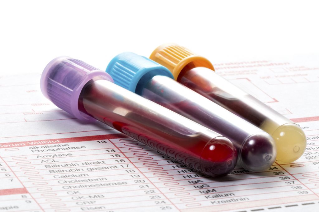Blood test - Steroidal.com